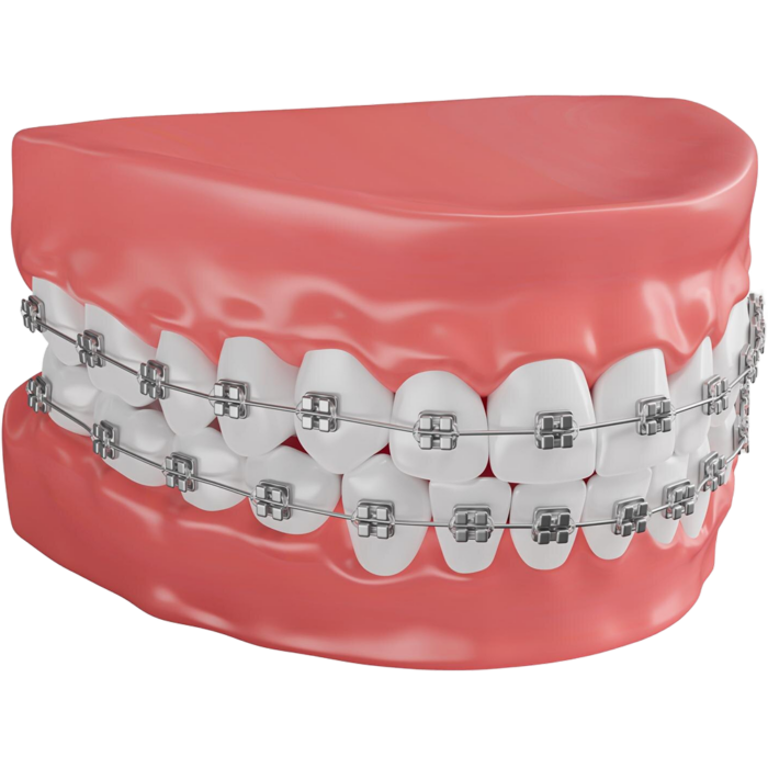 Dental Service Promotion - Scaling & Polishing